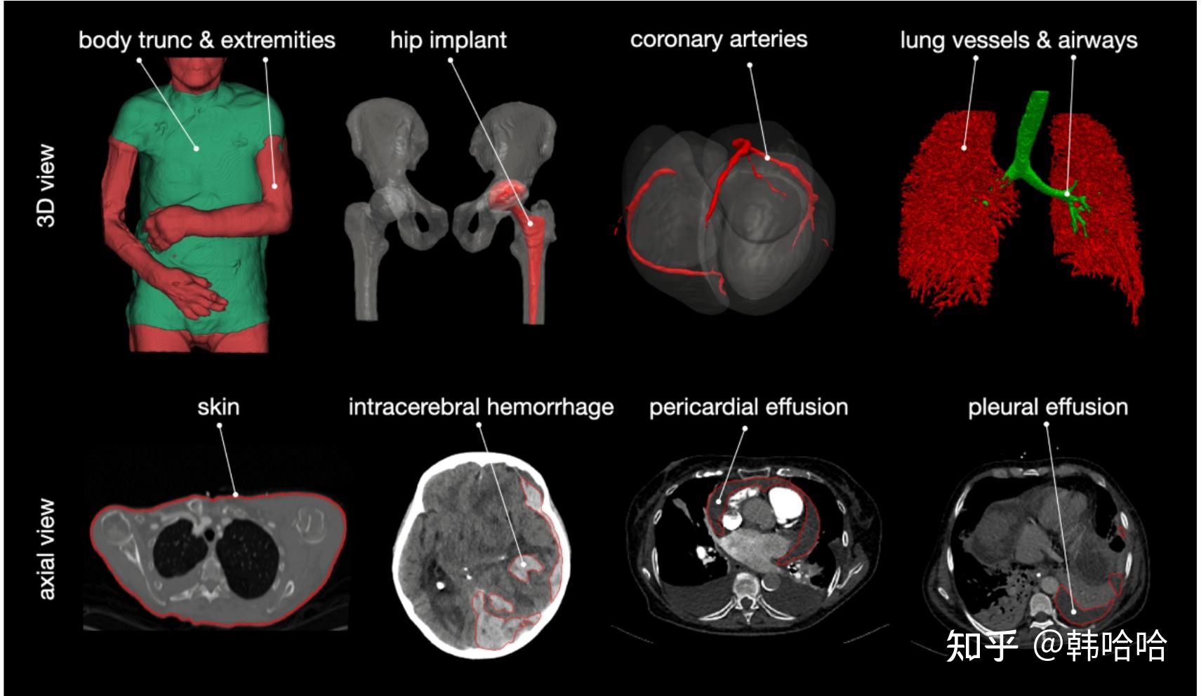 Python版：TotalSegmentator 安装与使用指南 - 知乎