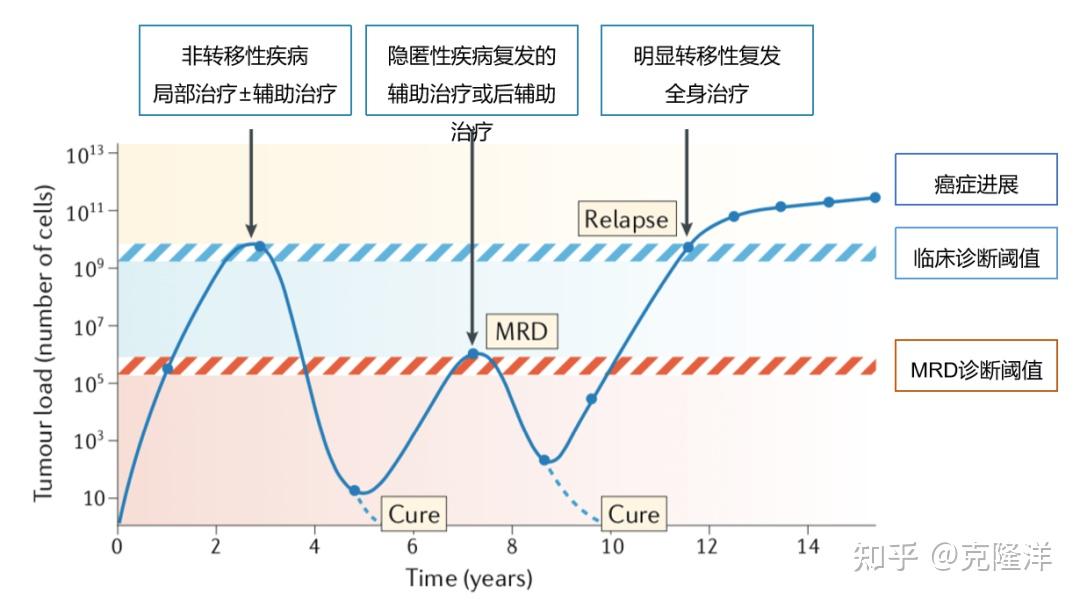 实体瘤分子残留病灶（MRD）检测共识发布 - 知乎
