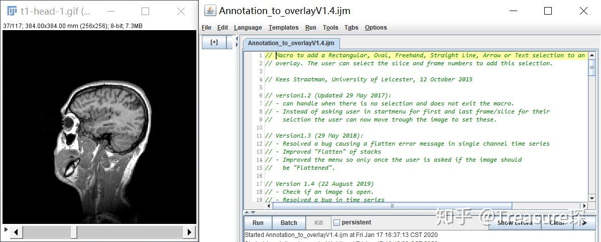 ImageJ实用技巧——图像标注(基本功能篇) - 知乎