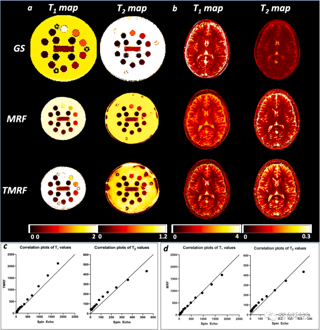 方法篇：定制磁共振指纹 - 知乎