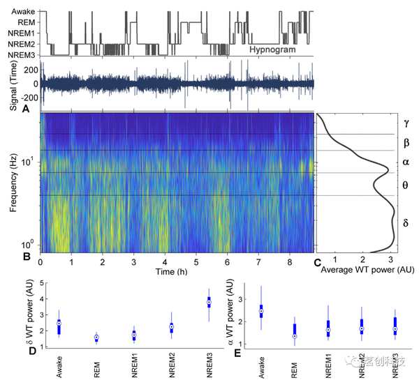 睡眠脑电中的神经跨频率耦合函数 - 知乎