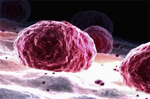 正确区分特发性血小板减少性紫癜与再障 知乎