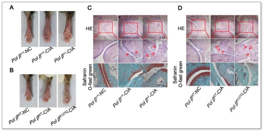 Cell Death Dis ￜ 南京师范大学的郭志刚/殷志敏/潘飞燕团队揭示DNA损伤修复蛋白在类风湿关节炎中的重要作用及发病机制 - 知乎