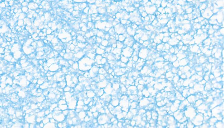 LFB髓鞘染色（步骤及流程） - 知乎