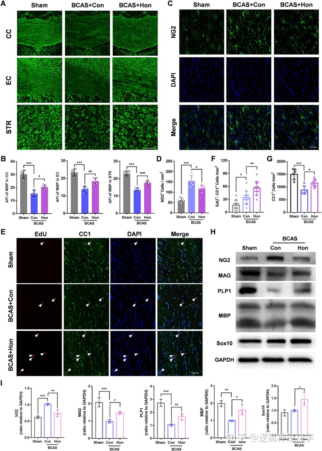 Neurosci Bull︱南京大学徐运课题组揭示小分子药物和厚朴酚改善缺血性脑白质损伤和相关认知障碍的机制 - 知乎