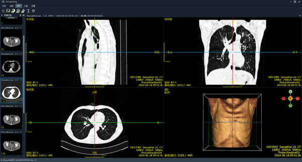 医学影像MPR（多平面重建）介绍 - 知乎