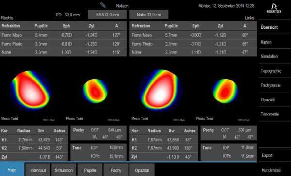 体验科技，见证品质之核心武器DNEye ® SCANNER 2 - 知乎