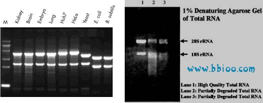 RNA的琼脂糖凝胶电泳实验原理和步骤 - 知乎