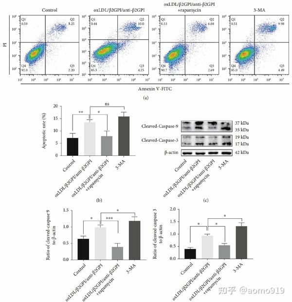 AbMole科研-oxLDL/β2GPI/抗-β2GPI复合物通过PI3K/AKT/mTOR和eNOS信号通路诱导的自噬受损有助于内皮细胞功能 ...