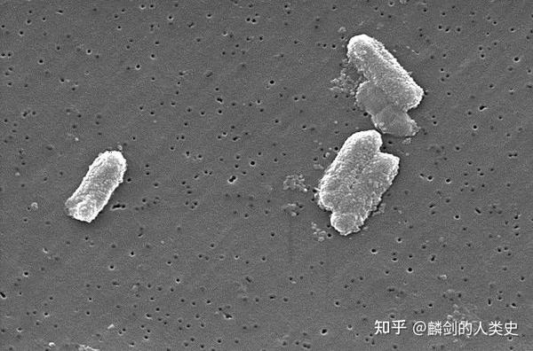 【地球生物全系列——从单细胞到人类】细菌界—酸杆菌门 - 知乎