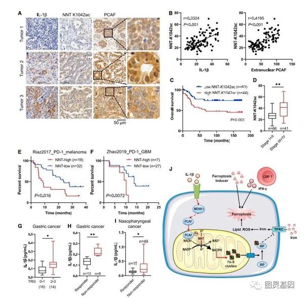 Mol Cell | 中山大学肿瘤医院徐瑞华团队发现 IL-1β诱导铁死亡机制 - 知乎