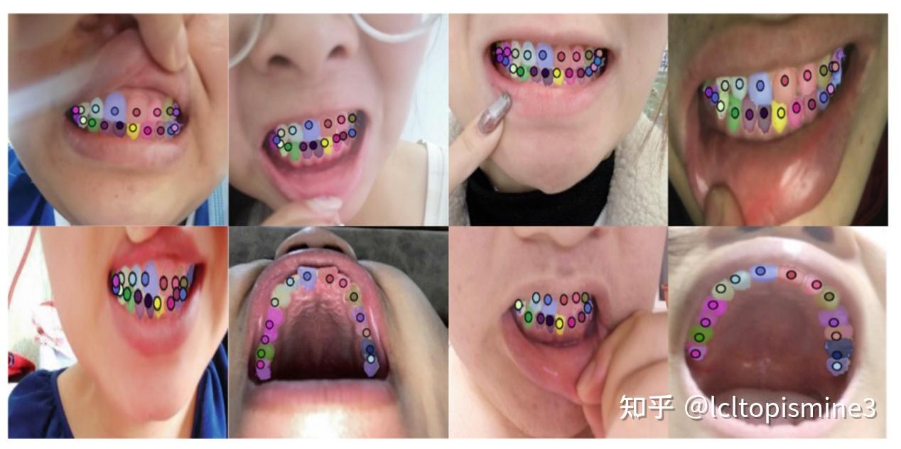 PAPK-Net ：基于牙齿位置先验的牙齿分割标号算法 - 知乎