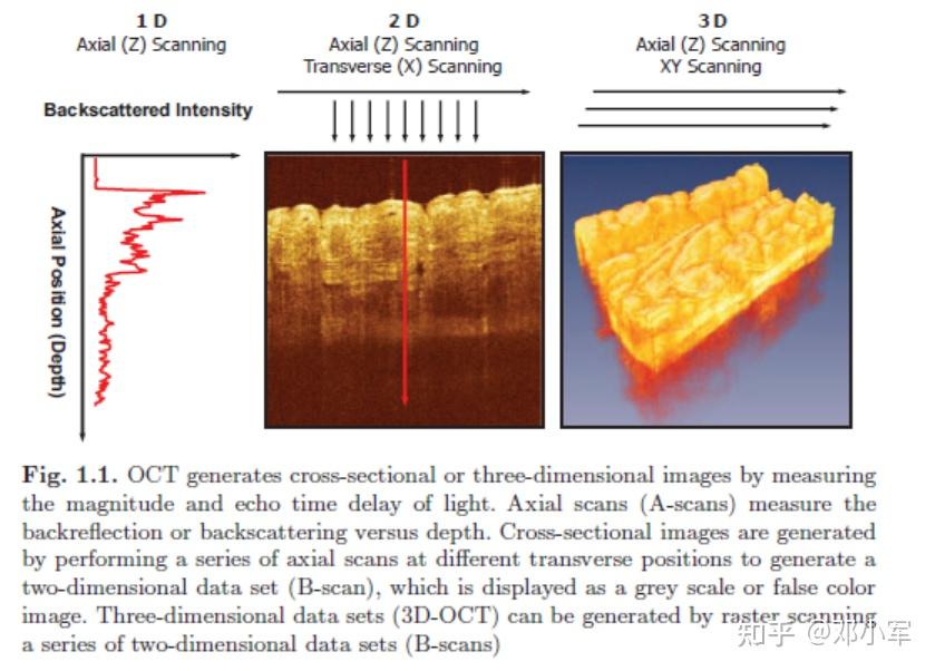 光学相干层析成像（Optical Coherence Tomography，OCT）简介 - 知乎