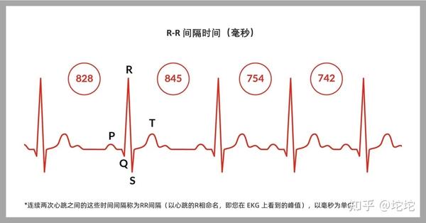 HRV状态有什么用？为何它的可靠性如此重要？ - 知乎