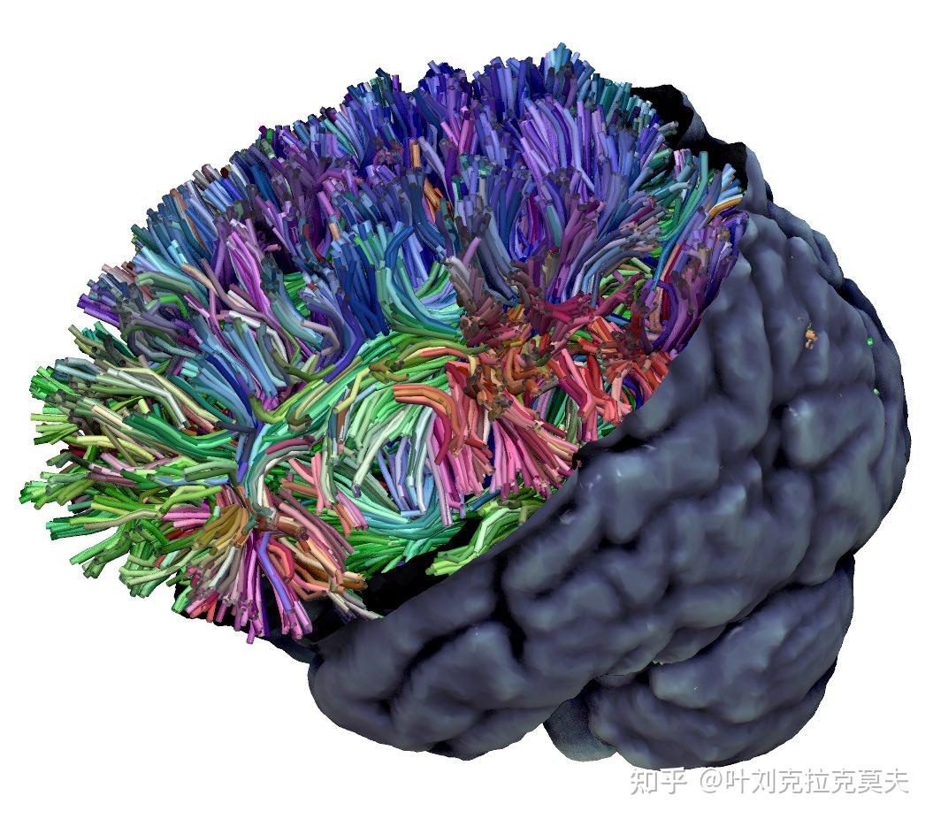 科学可视化软件介绍 – 人类大脑解剖图可视化软件Surf Ice - 知乎
