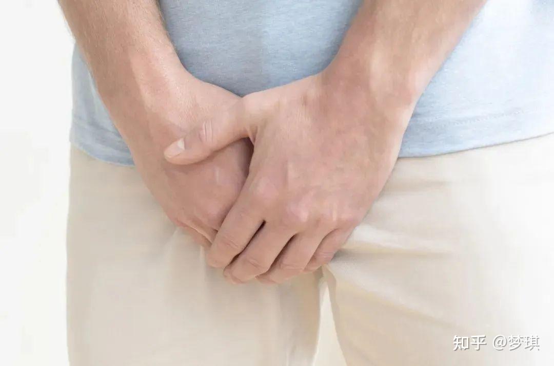 包皮龟头炎分6类，不同类型病因不同！ 知乎