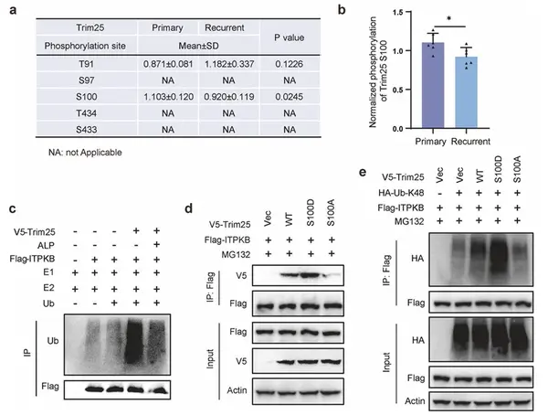 STTT | 中南大学湘雅医院揭示克服胶质母细胞瘤替莫唑胺耐药的新靶点 - 知乎