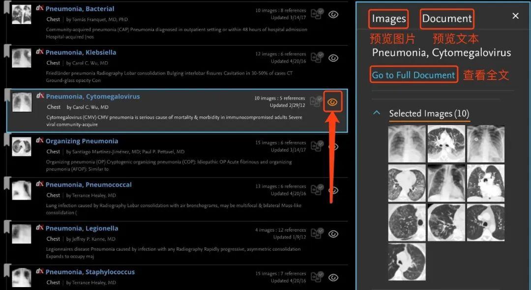 手把手教程：美国医生广泛好评的影像学工具STATdx用户指南 - 知乎