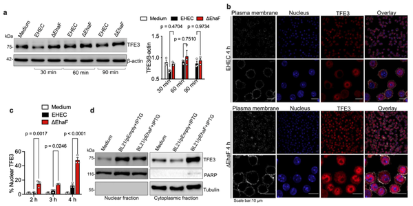 Nature Communications丨细菌自转运蛋白通过靶向转录因子 TFE3 损害先天免疫反应 - 知乎