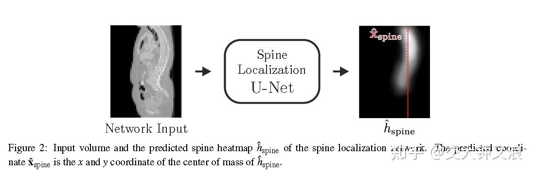 Coarse to Fine Vertebrae Localization and Segmentation with SpatialConfiguration-Net and U-Net - 知乎