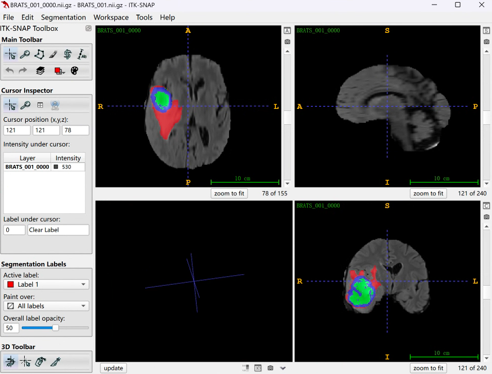 MSD Brain 数据集介绍 - 知乎