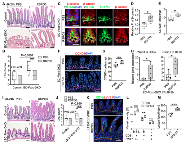 EMBO Reports丨内皮细胞 FOXC1 和 FOXC2 促进缺血再灌注损伤后的肠道再生 - 知乎