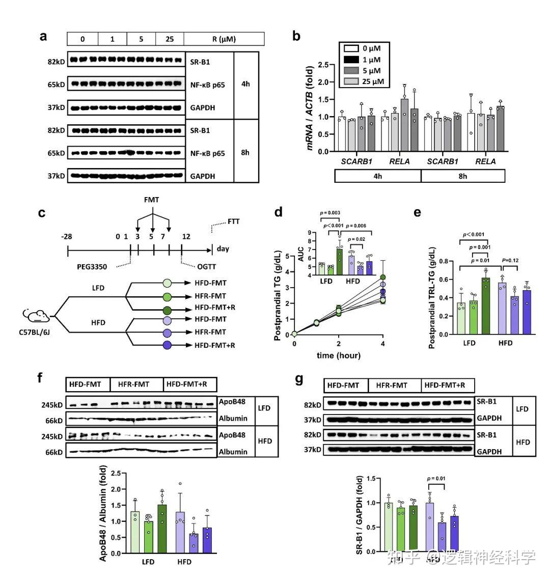 Nat Commun︱多伦多大学金天如/Khosrow Adeli与中山大学凌文华团队合作揭示白藜芦醇改善脂质稳态的新机制 - 知乎