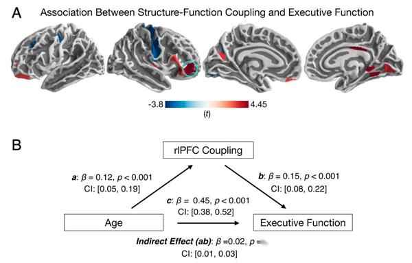 文献 | PNAS：青年时期人脑网络结构-功能耦合的发展 - 知乎