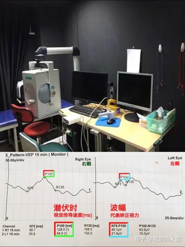 孩子弱视VEP检查，一文秒懂科普 - 知乎