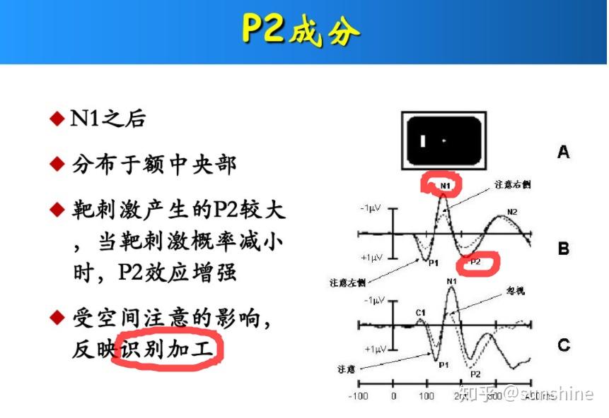 ERP成分（N1/P2/N400） - 知乎