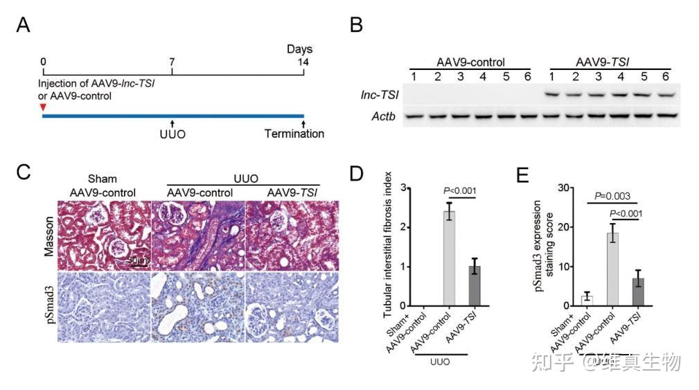 『AAV病毒载体』如何靶向治疗肾脏疾病？ - 知乎