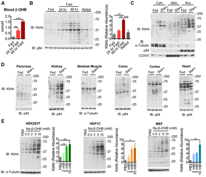 Cell Rep | 3-羟基丁酰化修饰组学揭示酮体生成对肝脏代谢的影响 - 知乎