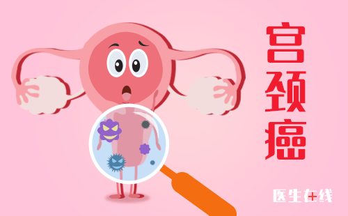 怎么检查宫颈癌？ 知乎