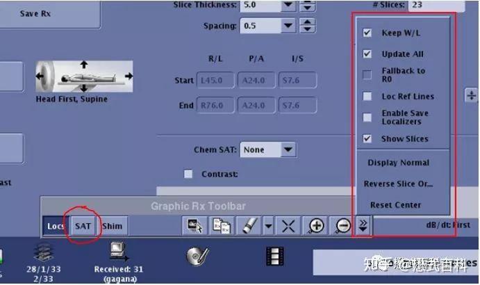 磁共振参数的名称（不同厂家之间的专业术语）（五） - 知乎