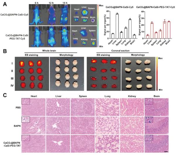APSB | 湘雅毛小元/刘昭前·兰大金卫林教授等合作揭示铁死亡与癫痫脑损伤之间的分子机制 - 知乎