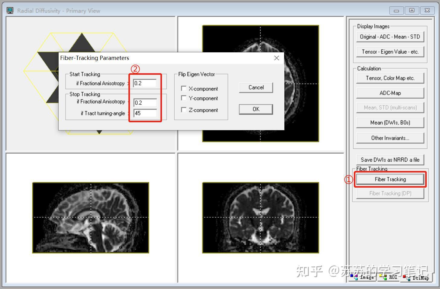 DTI Studio操作教程 - 知乎