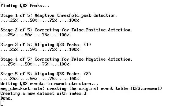 同步脑电-功能磁共振（EEG-FMRI）伪影去除方法及工具箱介绍 - 知乎