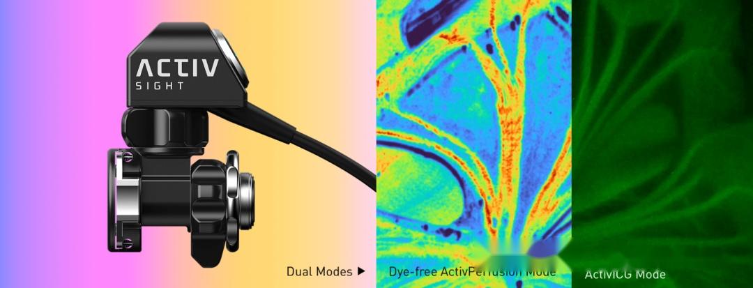 4亿元 ! 数字手术成像公司Activ Surgical 完成B轮融资 | 融资 - 知乎