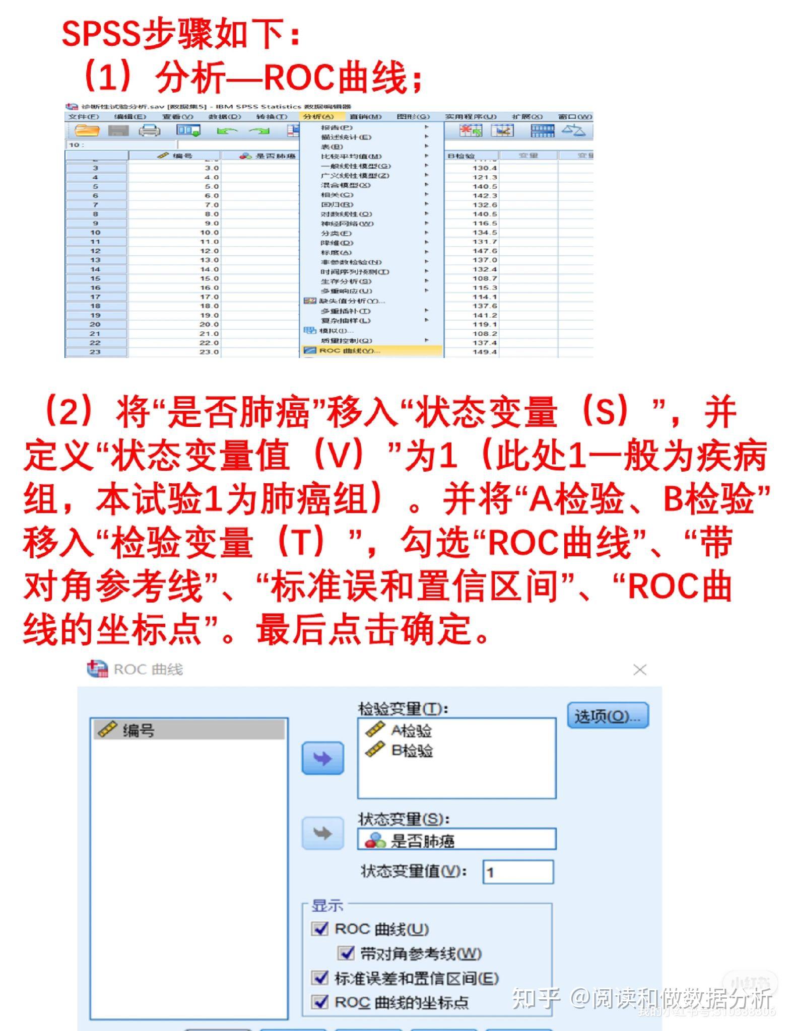 SPSS ROC曲线诊断临界值确定 - 知乎