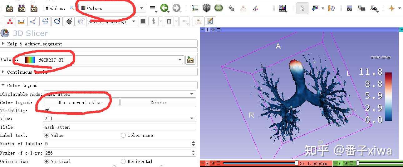 3D slicer 可视化pred和mask之间的距离 - 知乎