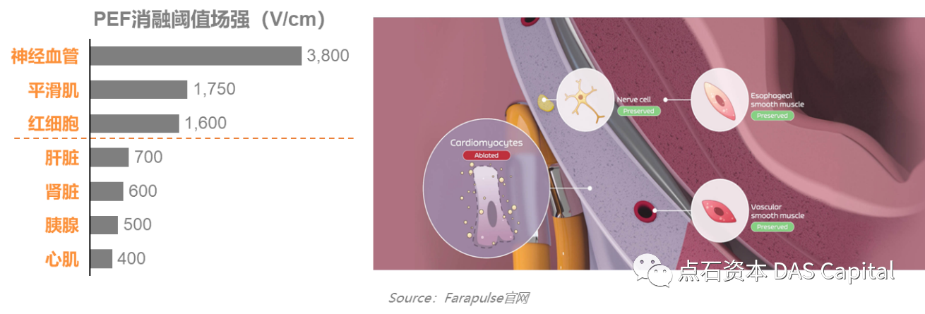 行研 | 百舸争流，奋楫者先，PFA或将颠覆房颤导管消融格局 - 知乎
