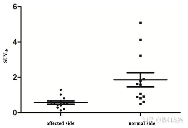 68Ga-NOTA-Evans Blue PET/MR 淋巴显像在评估下肢淋巴水肿中的应用 - 知乎