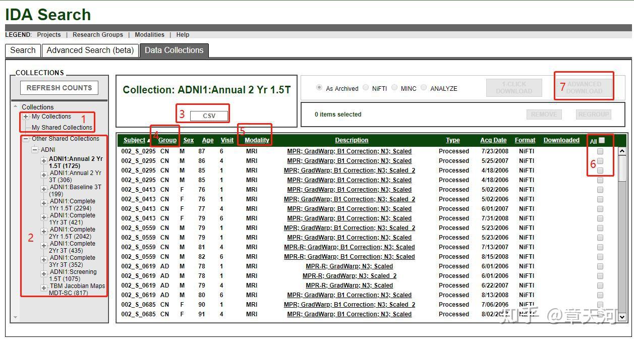 ADNI 数据集阅读整理 - 知乎