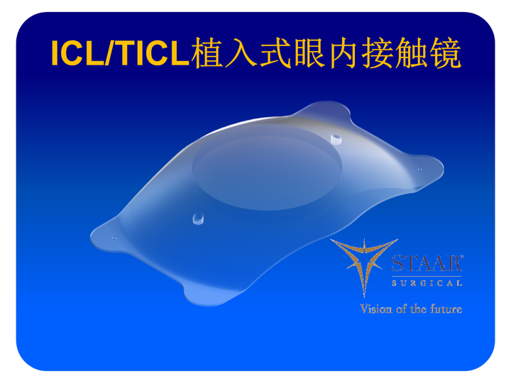 ICL晶体的使用寿命是多少？你知道吗 - 知乎