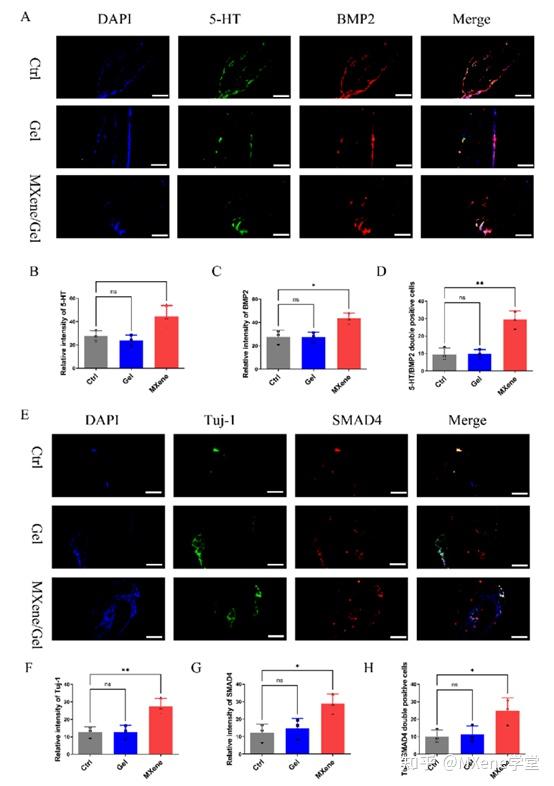 Mo2Ti2C3 MXene基水凝胶修复中神经形成和骨再生能力 - 知乎