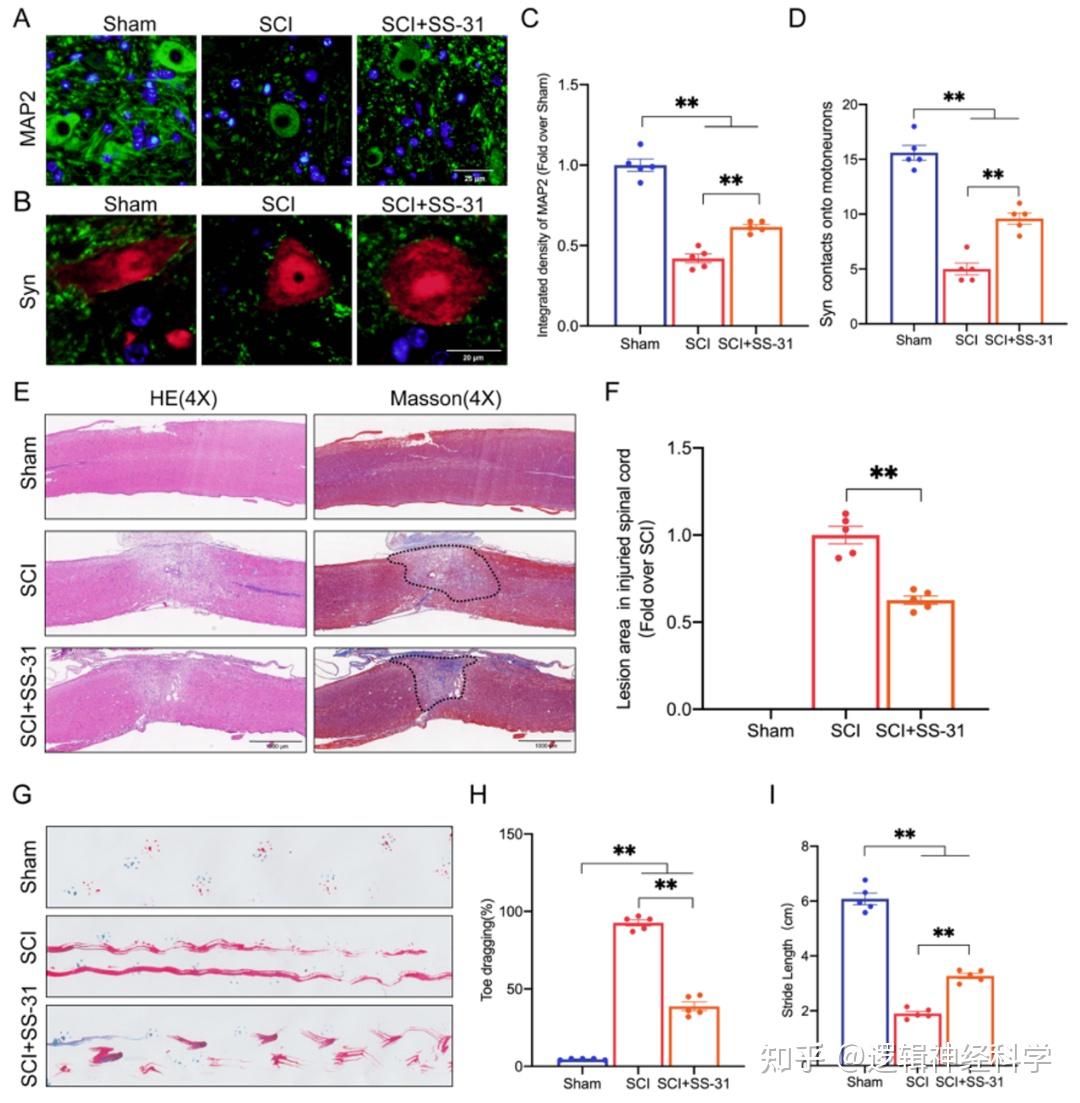 J Neuroinflammation︱周凯亮/倪文飞团队揭示线粒体靶向抗氧化肽治疗脊髓损伤的新机制 - 知乎