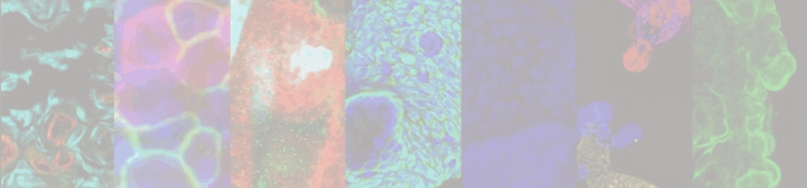 如何区分PDX/PDXO还是PDO/PDOX模型？ - 知乎