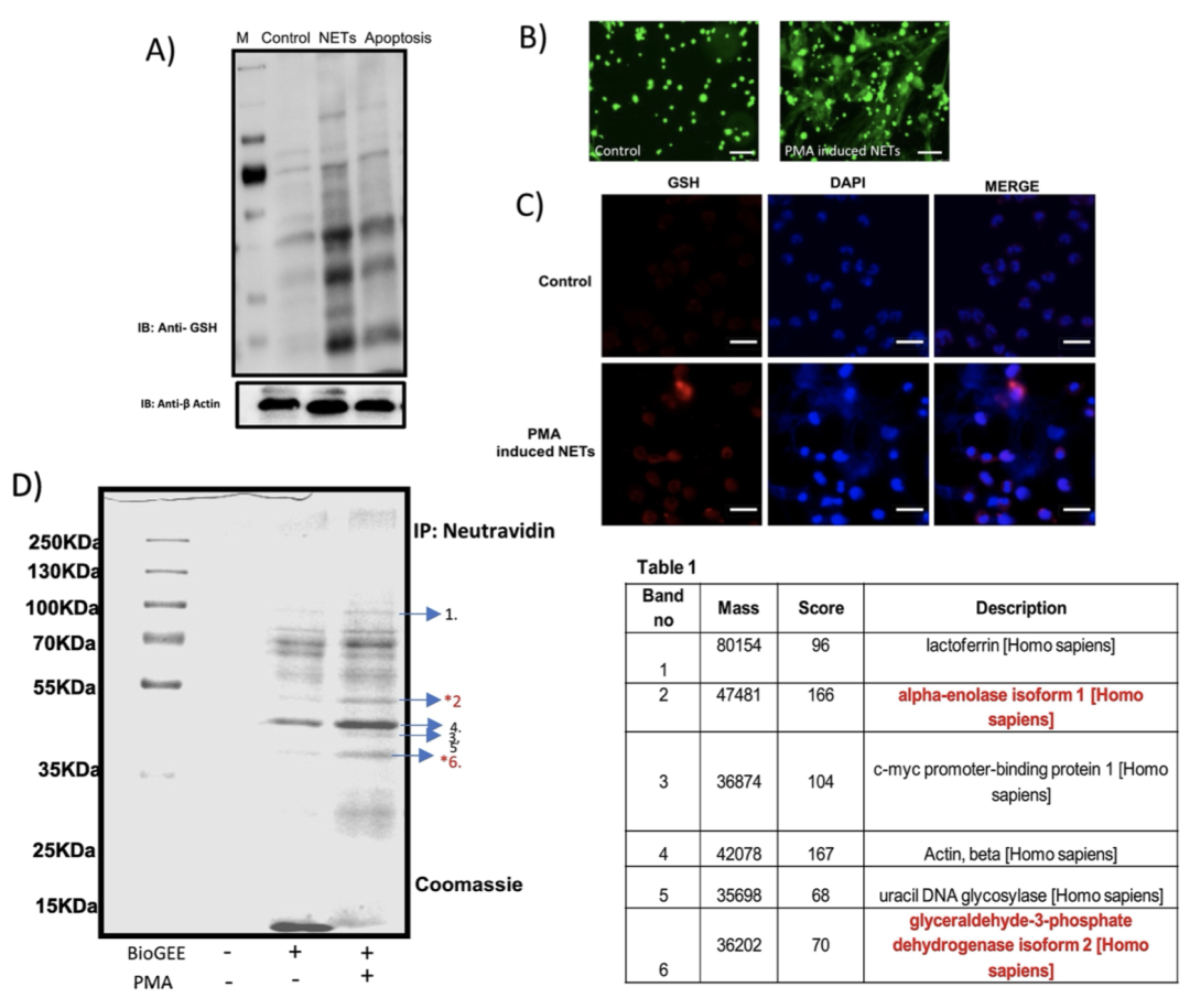 BBA丨中性粒细胞NETs与细胞代谢的关系 - 知乎