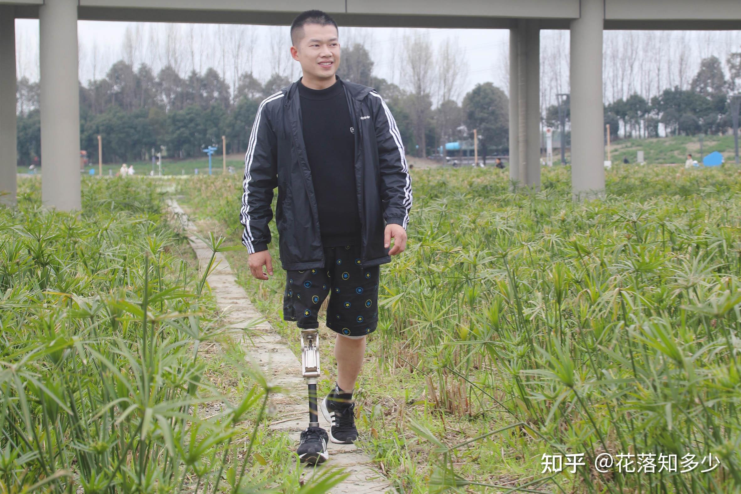患者装配假肢前可以做哪些准备 知乎