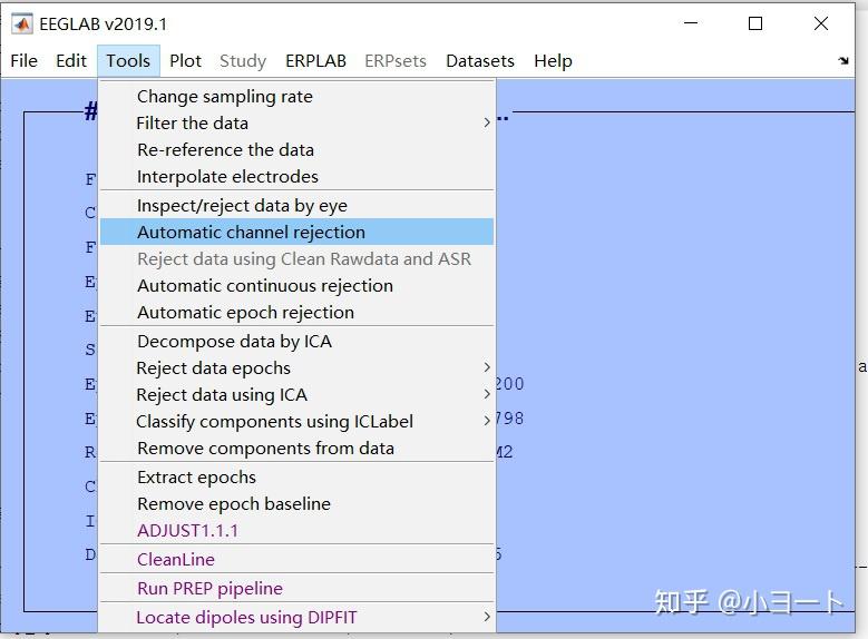 手把手系列教程：使用ERPLAB进行单个被试的ERP分析 - 知乎